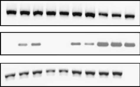 Rt Pcr Analyses Osm Osm Specific Receptor Osmr And Gp130 In Cell Download Scientific