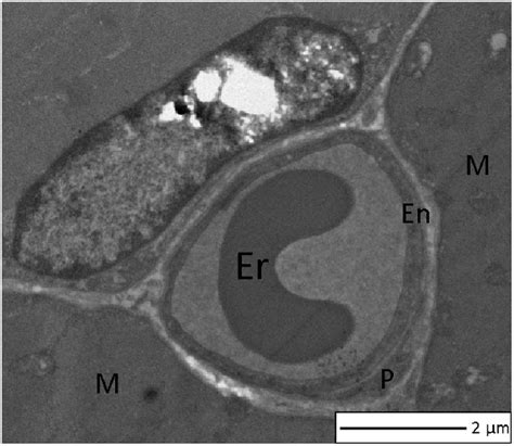 Transmission Electron Micrograph Of A Section Through The Capillary Download Scientific Diagram