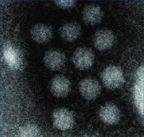 Electron Microscopy Picture Of Astrovirus Larger Particles Of 18 20