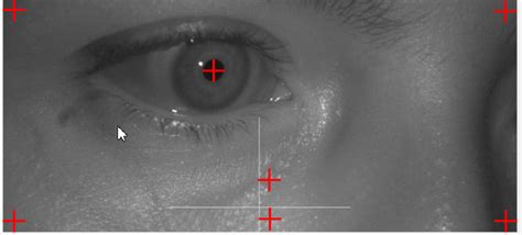 Matlab Pupil Detection With Hough Transform Stack Overflow