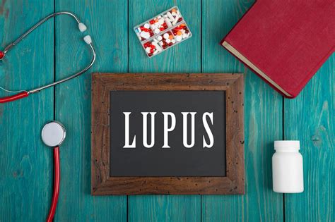 Lupus Cosè E Come Riconoscerlo Sintomi E Prevezione Della Malattia