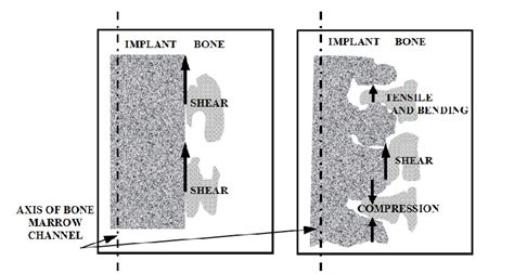 Smooth Vs Porous Bone Implant Interface 8 Download Scientific Diagram