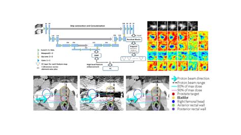 Adaptive Proton Therapy
