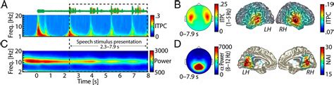 Spatiotemporal Dynamics Of Auditory Attention Synchronize With Speech Pnas