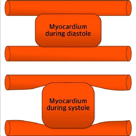 Myocardial Contraction Results In Muscle Shortening And Thickening To