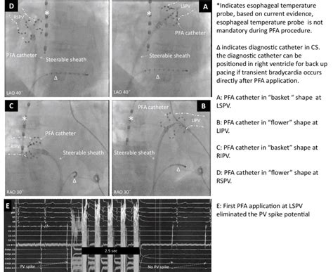 Example Of Pfa For Each Pv With Different Configurations Download