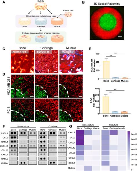 Spatially Patterned 3d Model Mimics Key Features Of Cancer Metastasis To Bone Pmc
