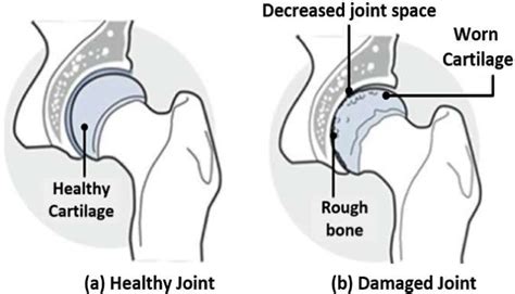 Figure 1 From Cmos Image Sensor Design And Image Processing Algorithm Implementation For Total