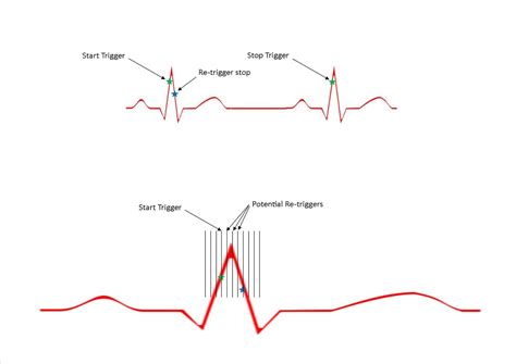 Photoplethysmography Ir Heart Rate Monitor 5 Steps With Pictures Instructables