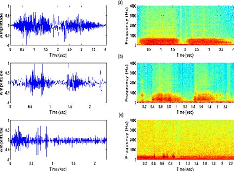 Figure 1 From Optimization Of Cepstral Features For Robust Lung Sound Classification Semantic