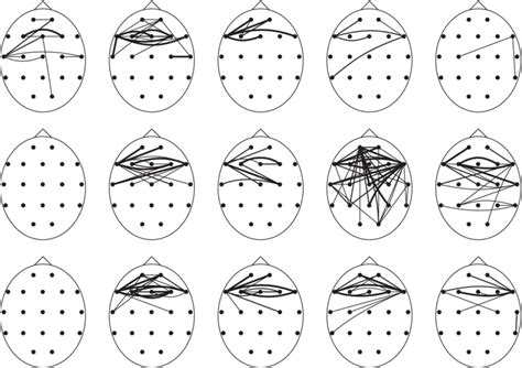 Significant Differences In The Eeg Spatial Synchronization Between The Download Scientific