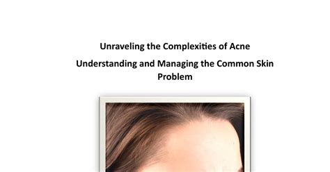 Unraveling The Complexities Of Acne Pdf DocDroid