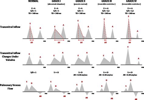 Classification Of Diastolic Dysfunction Grades I Iv Download Scientific Diagram