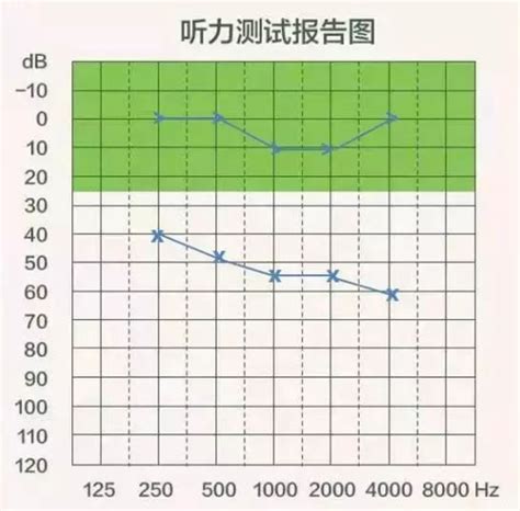 听力科普听力图听力计麦力声广州市麦力声医疗器械有限公司