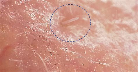 Tiny Eight Legged Creatures Have Sex On Your Face While You Sleep Researchers Say Wales Online