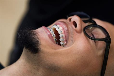 The Dos Donts Of Wearing Braces Saddle Creek Orthodontics