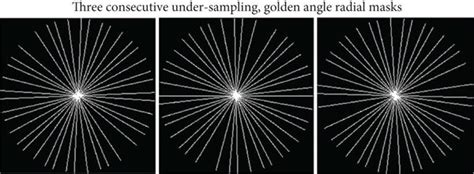 Three Consecutive Undersampling Radial Masks With Nonoverlapping Spokes Download Scientific