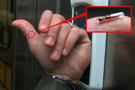 Human Implanted Microchips Back In The Spotlight JOY News