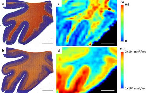 Histology And Mri Quantitative Maps Colour Deconvolution Markup Download Scientific Diagram