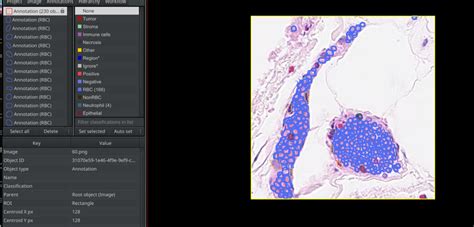 qupath v 0 5 tensorflow issue usage and issues image sc forum
