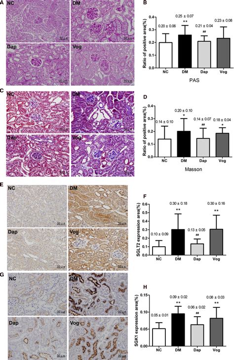 dap treatment partly reversed renal fibrosis and inhibited sglt2 and