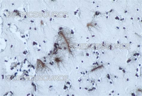 Proteus Vulgaris Stock Image Science Source Images