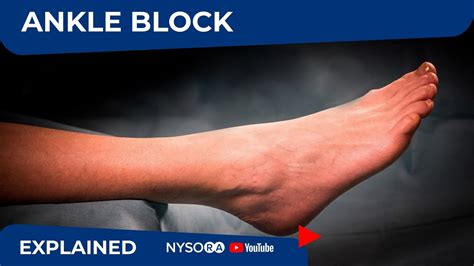 Ultrasound Guided Ankle Block Video Nysora