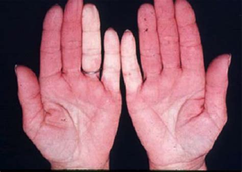 C3 Part 3 Flashcards Quizlet