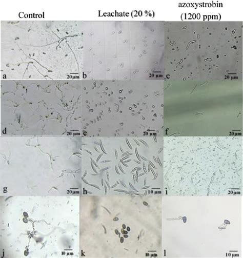 Figure 1 From Antifungal Activity Of Banana Rachis Leachate On Some Fungi Responsible For Banana