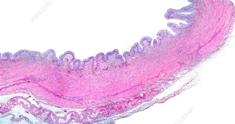 Urinary Bladder Light Micrograph Stock Image C0563698 Science