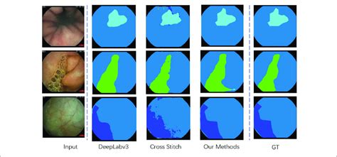 Visualization Of The Segmentation Result In Our Proposed Download Scientific Diagram