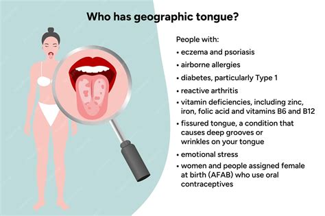 Geographic Tongue Causes Medical Illustration Premium Vector