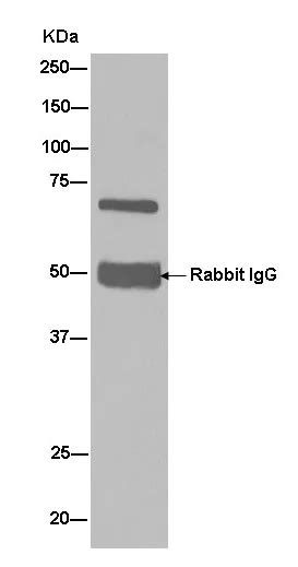 Anti Cpeb1 Antibody [epr11775 2 ] Ab181051 Abcam