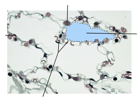 Lung Diagram Quizlet