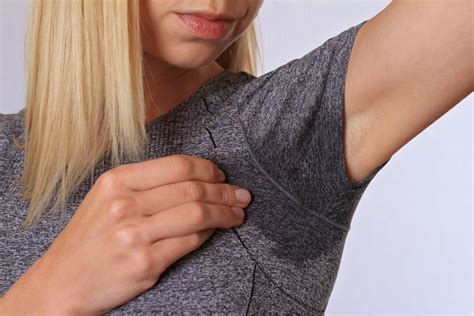 Best Hyperhidrosis Treatment Duradry