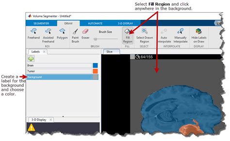 Create Semantic Segmentation Using Volume Segmenter Matlab And Simulink