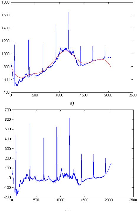 Figure 1 From Electrocardiogram Baseline Wander Removal Using Stationary Wavelet Approximations