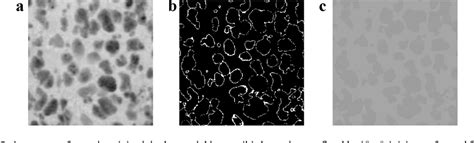 Figure 2 From Modified Local Entropy Based Transition Region Extraction And Thresholding