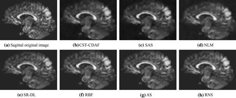 sagittal slice image after denoising by different algorithms download