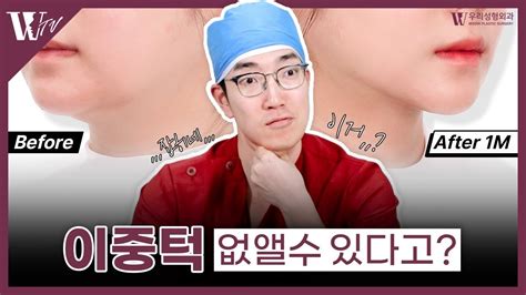 이중턱의 원인을 알아야 확실히 없앨 수 있다 ㅣ 이중턱근육묶기 Youtube