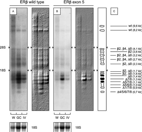 Detection Of Er Deletion Variants Missing Exon 5 And A Summary Of Er Download Scientific