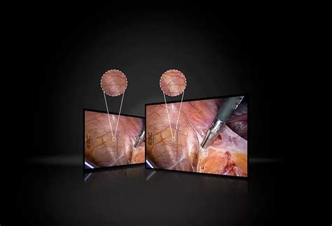 4k Laparoscopic Camera Imaging System Uhd Lp 6000 Esc Medicams