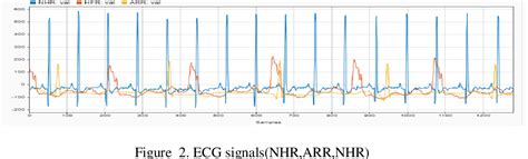 Figure 1 From Wavelet Scattering Transform For Ecg Cardiovascular