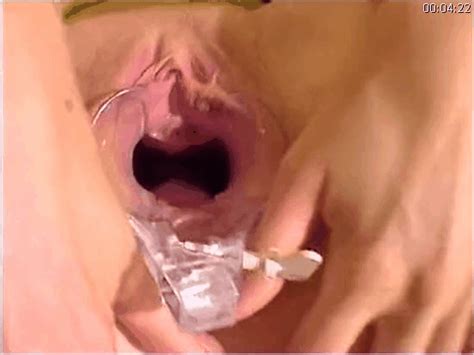 Medical Fetishes Enema Gyno Exam Clinic Page 50