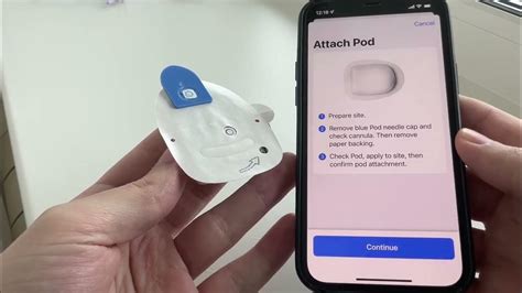 Omnipod Dash обзор установка на Iphone 12ios 15 Freeaps X