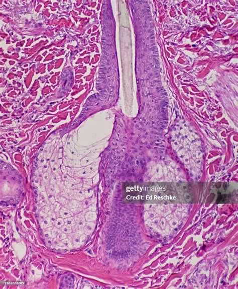 Hair Follicle And Sebaceous Glands Dermis Human Scalp 50x High Res