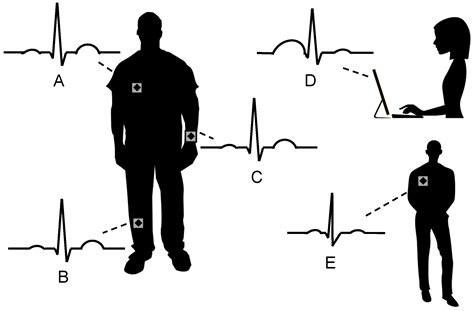 Sensors Free Full Text Design Of Secure Ecg Based Biometric Authentication In Body Area