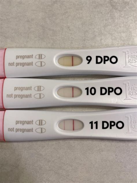 Elevated Crp Level Rpancreatitis