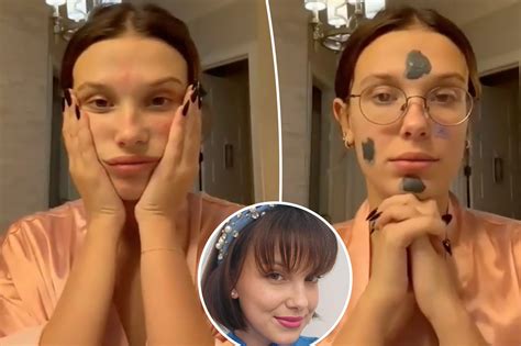 Millie Bobby Brown Gets Candid About Her Acne In No Makeup Video