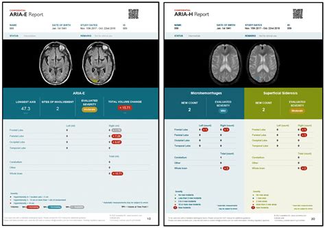 A New Era For Quantitative Brain Mri Analysis Applied Radiology